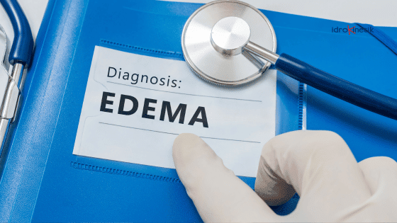 Edema della Spongiosa Ossea: cause e trattamento • Idrokinetik